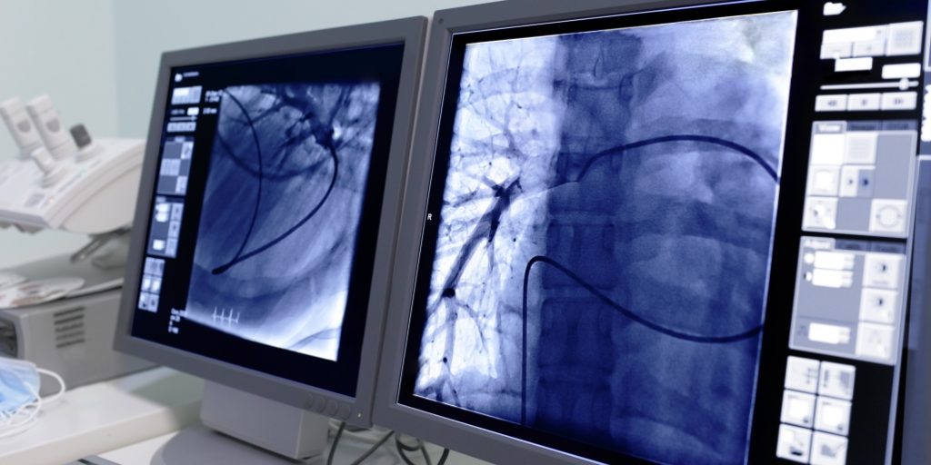 Radiography (B.S.) - University of St. Francis